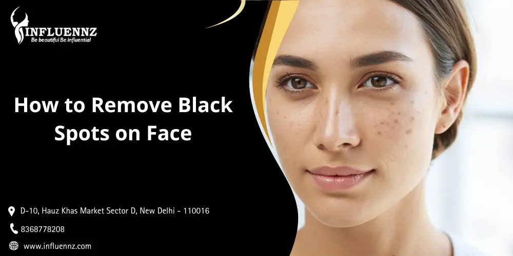 How to Remove Black Spots on Face: How Dermatologists Treat Them Safely